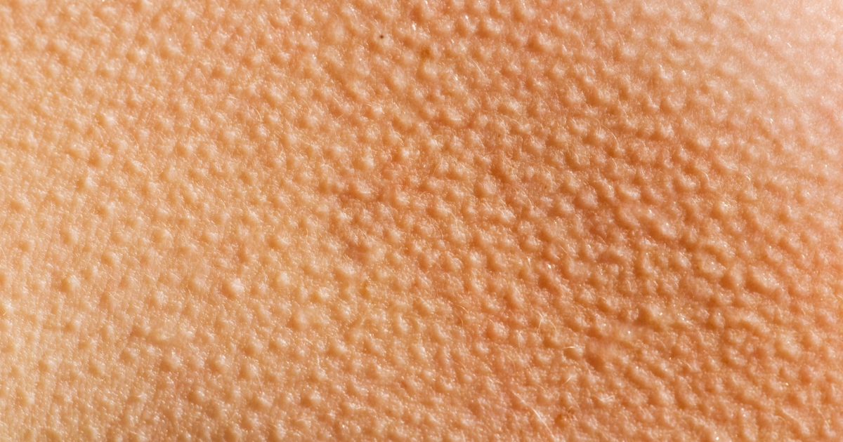 Fra gåsehud til ørevoks: 6 spøjse ting, du ikke vidste om din krop