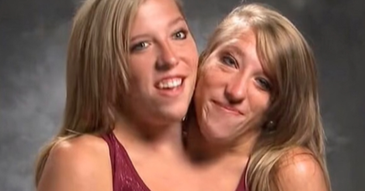 She Said Yes Conjoined Twin Abby Hensel Gets Married