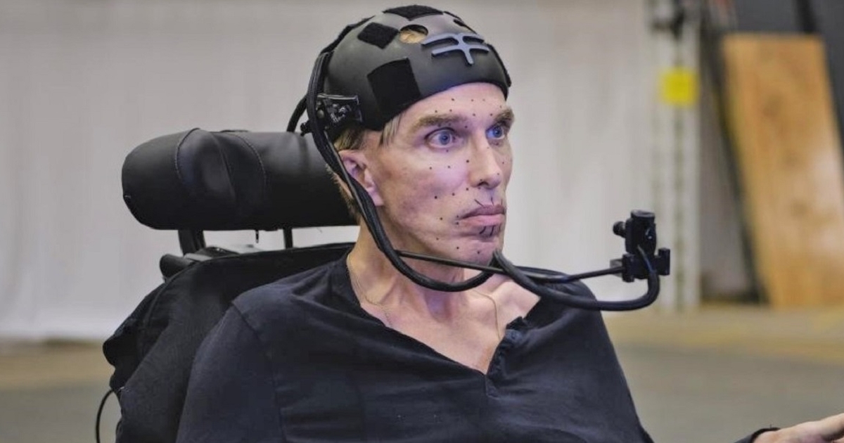 'Verdens første cyborg' er død