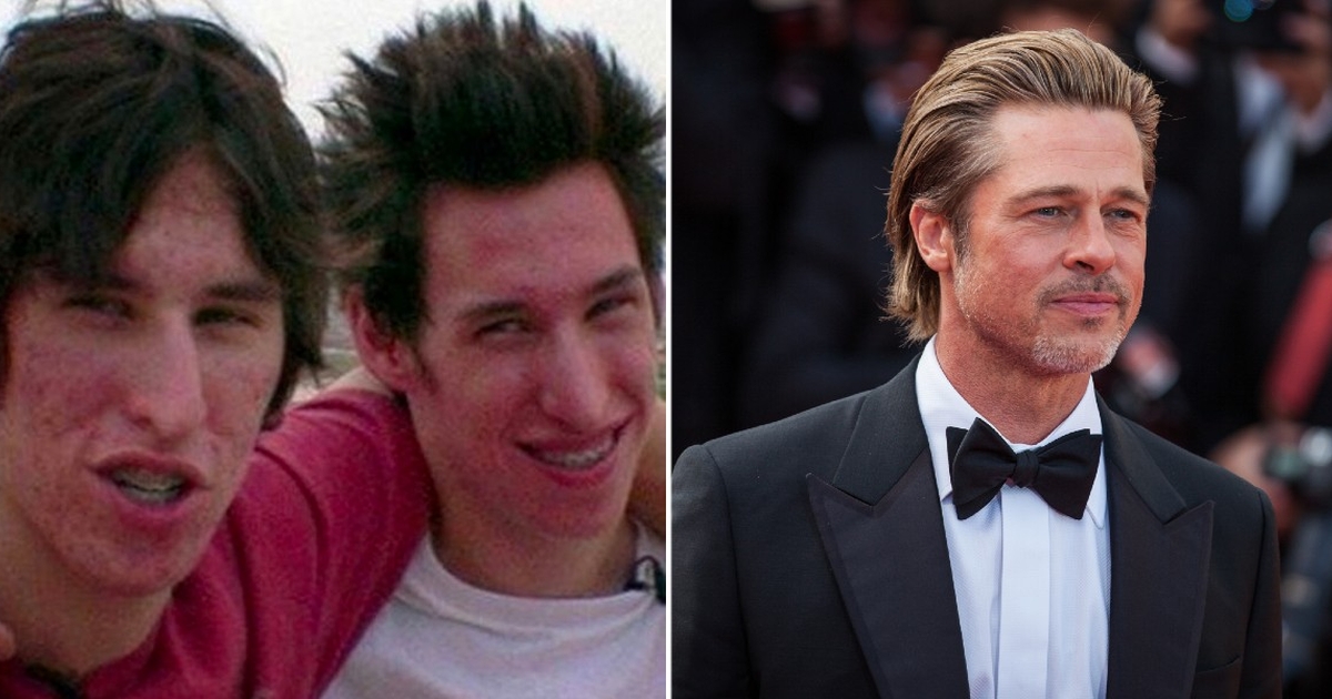Tvillinger brugte 130.000 kroner på at ligne Brad Pitt: Sådan blev ...