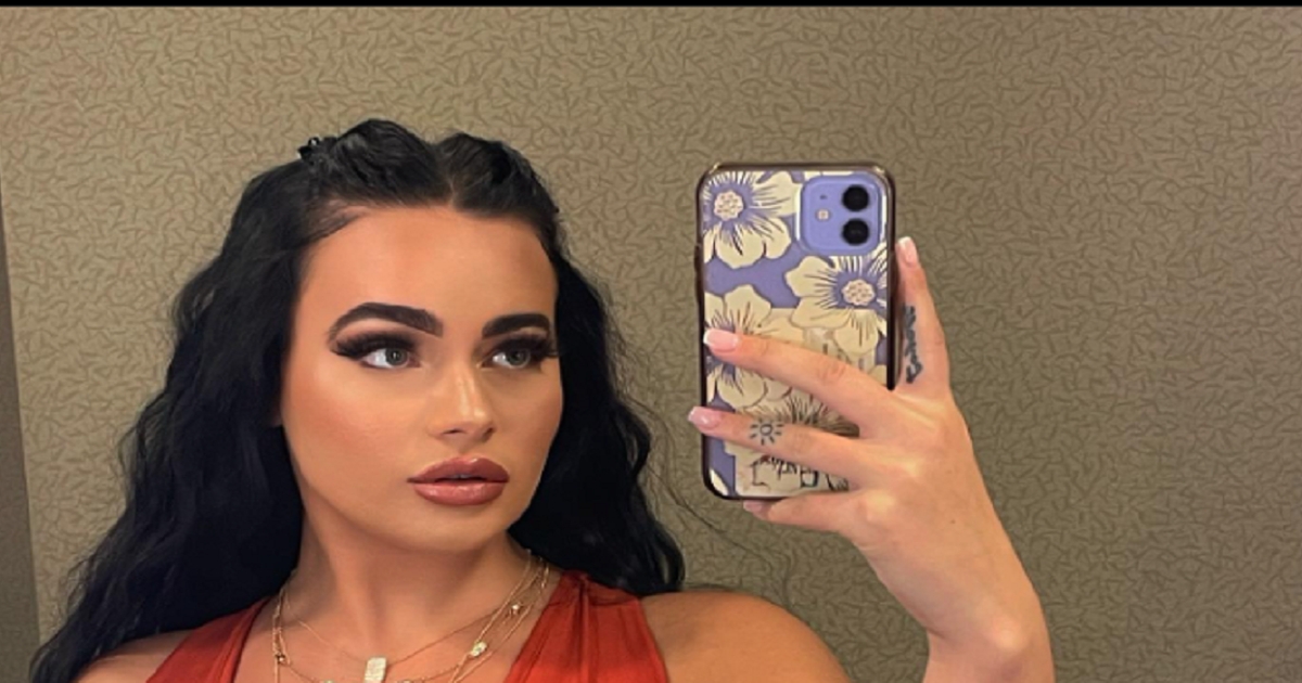 Jessica fik lavet læbefiller som gik helt galt: Nu advarer hun andre